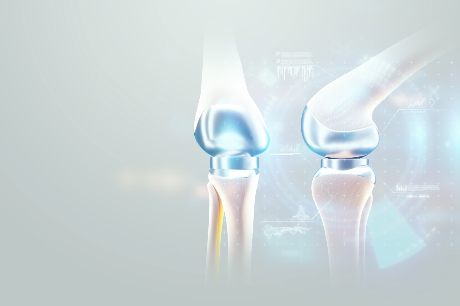 Arthritis Treatment in Turkey | Check 2026 Cost & Prices