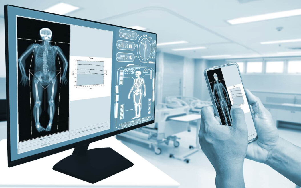 Bone Density Test in Turkey | Medical Check Ups in Turkey
