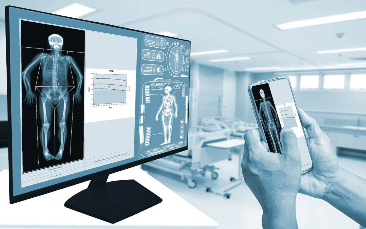 Bone Density Test in Turkey | Medical Check Ups in Turkey