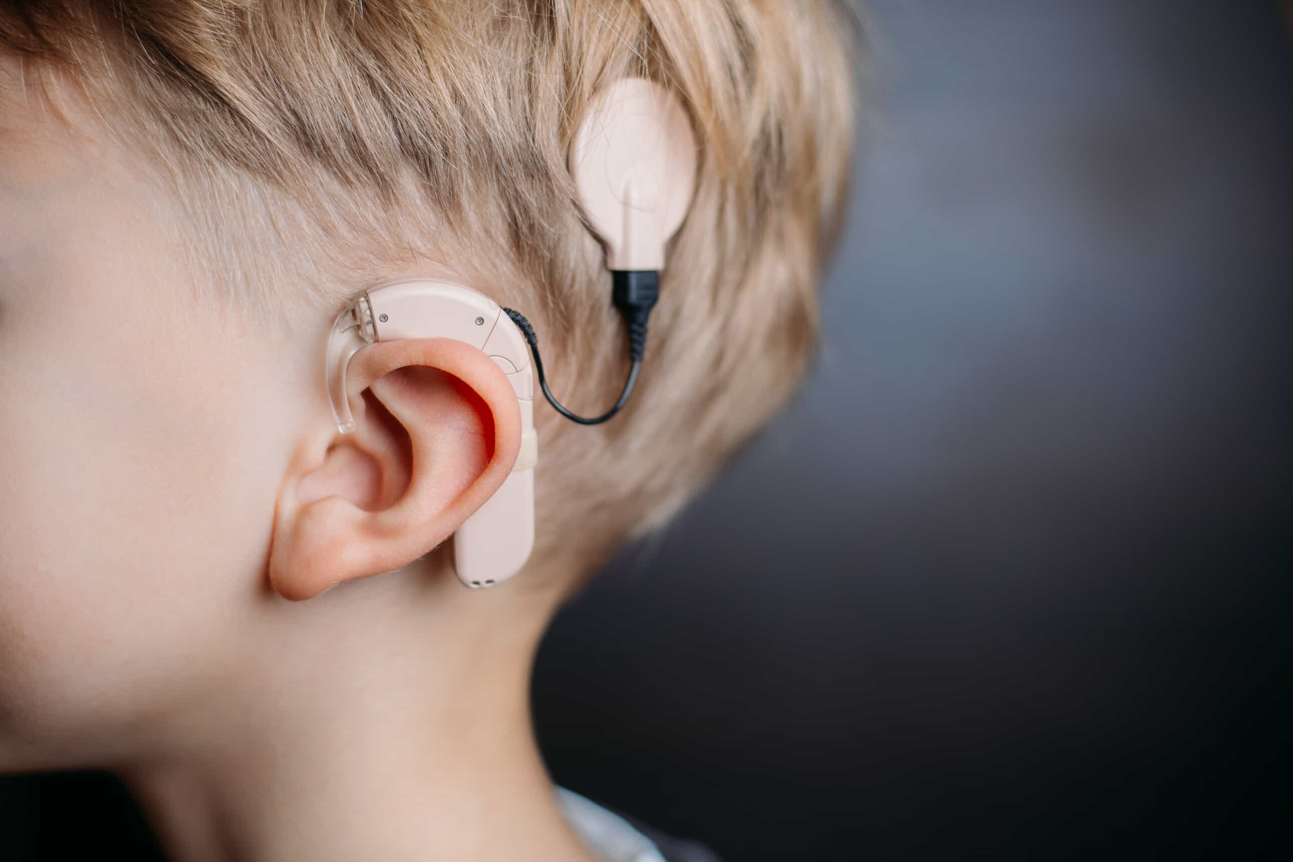 Cochlear Implant in Turkey | Check 2026 Cost & Prices