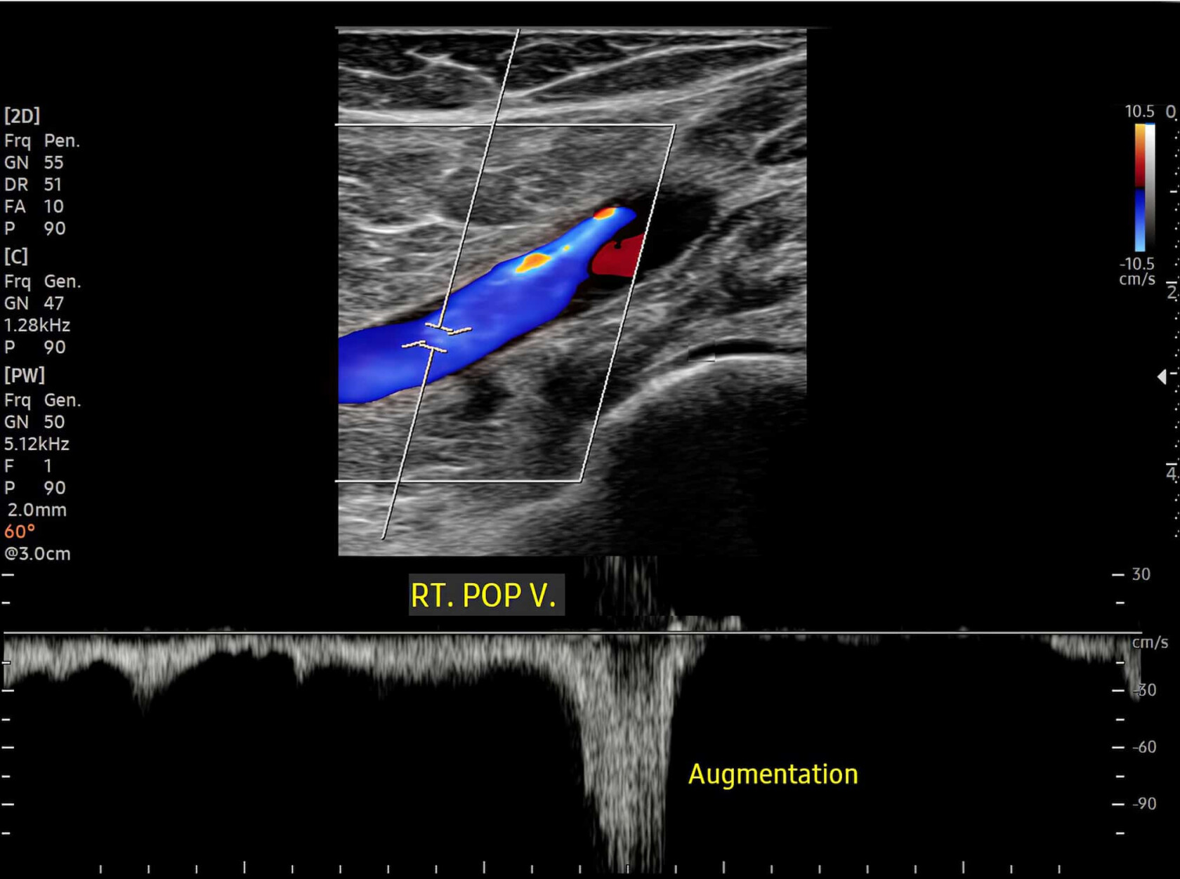 Colour-Duplex Sonography in Turkey | Cardiology Examination