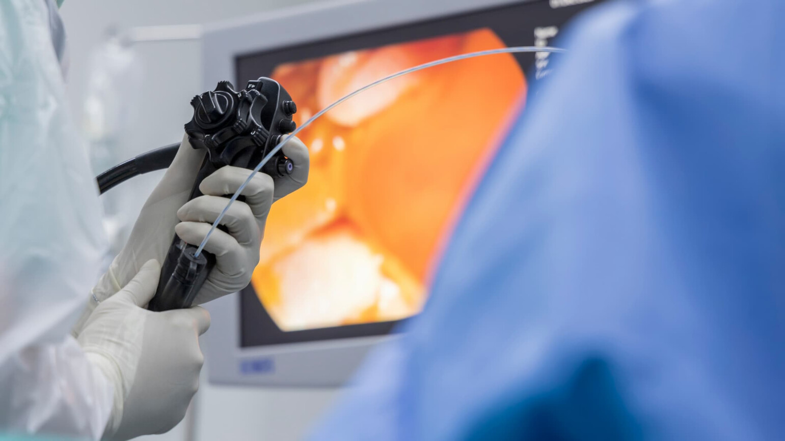 Ercp In Turkey Ercp In Turkey Free Online Consultation