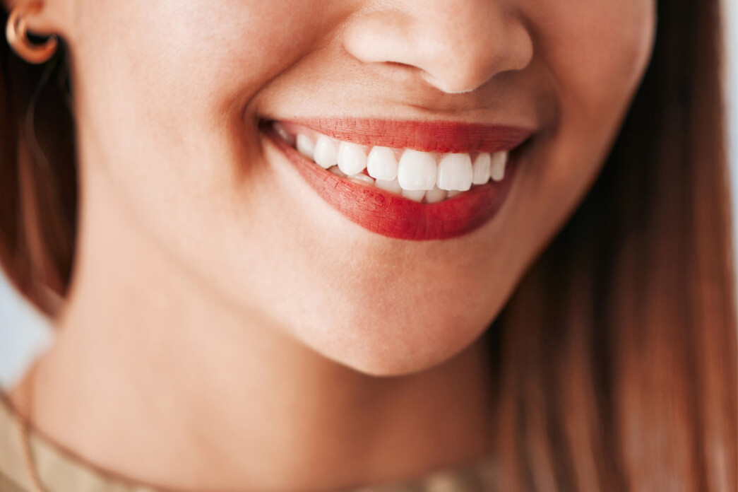 Full Set Veneers | Veneers in Turkey | Healthy Türkiye
