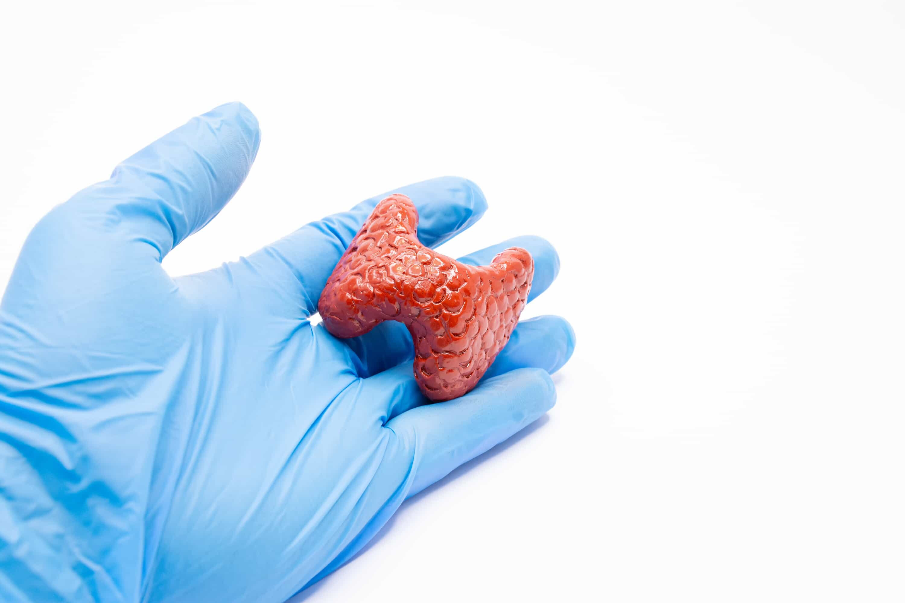 Hyperthyroidism Treatment in Turkey | 2025 Cost and Prices