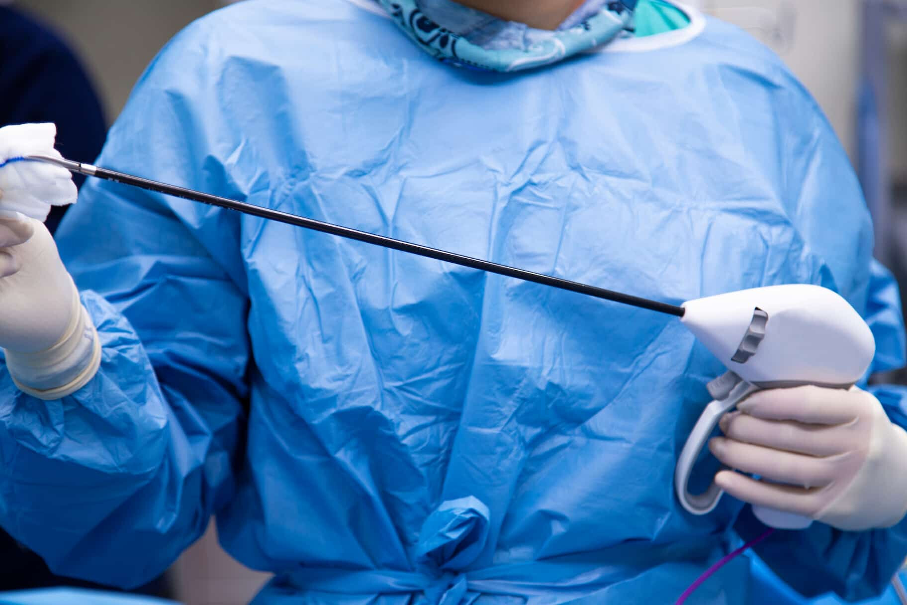 Laparoscopic Sleeve Gastrectomy in Turkey | Gastric Sleeve