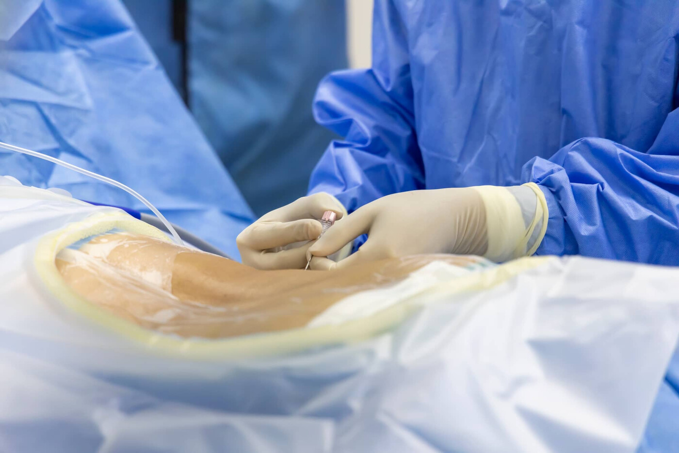 Micro Lumbar Discectomy in Turkey | Check 2026 Cost & Prices