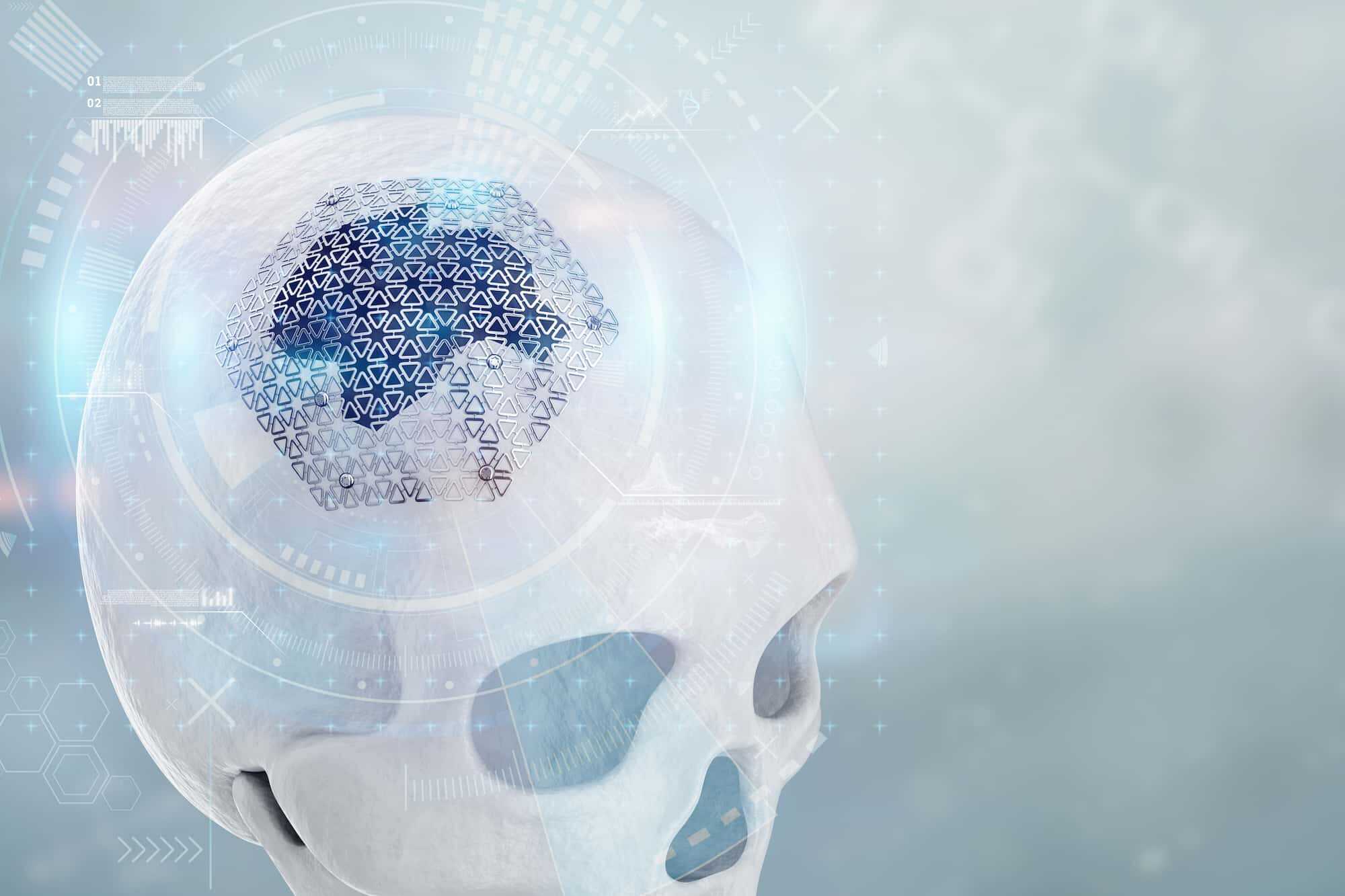 Traitement des Neurotraumatismes en Turquie | Neurochirurgie en Turquie