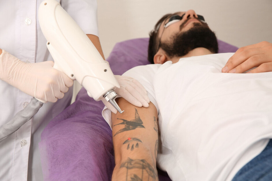 Tattoo Removal Cost in Turkey | Tattoo Removal Cost