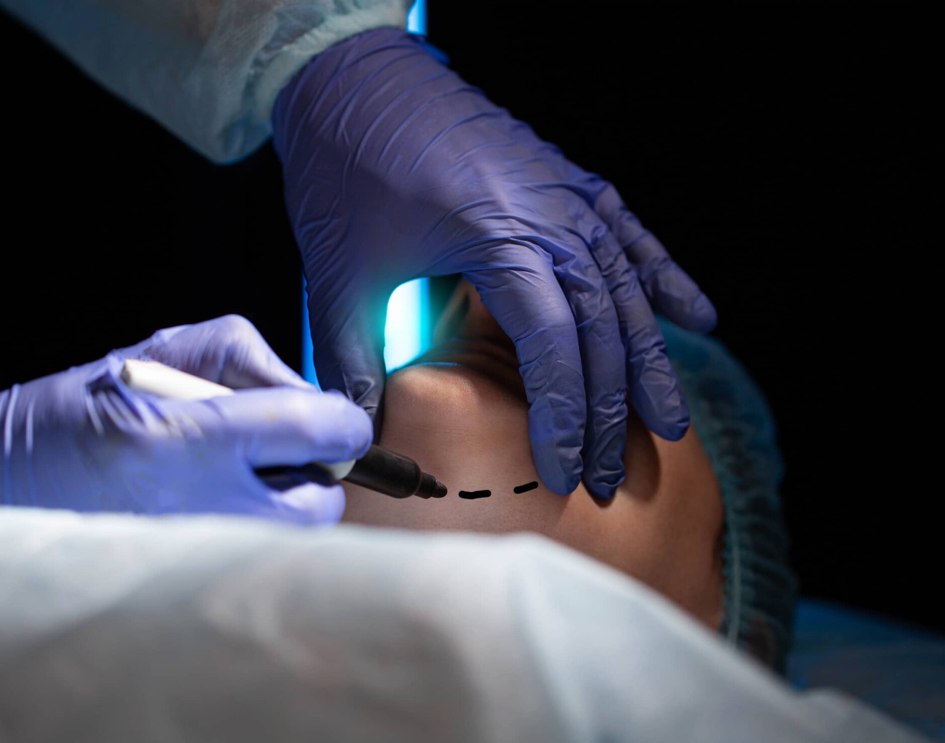 Chin Augmentation in Turkey | Affordable Procedure Prices