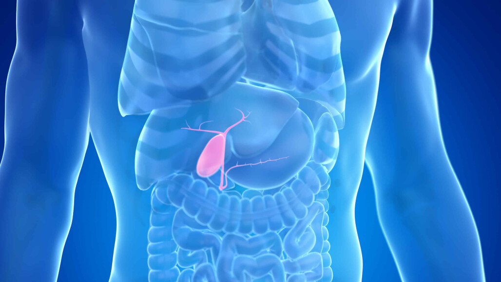 Cholecystectomy in Turkey | Gallbladder Removal Surgery