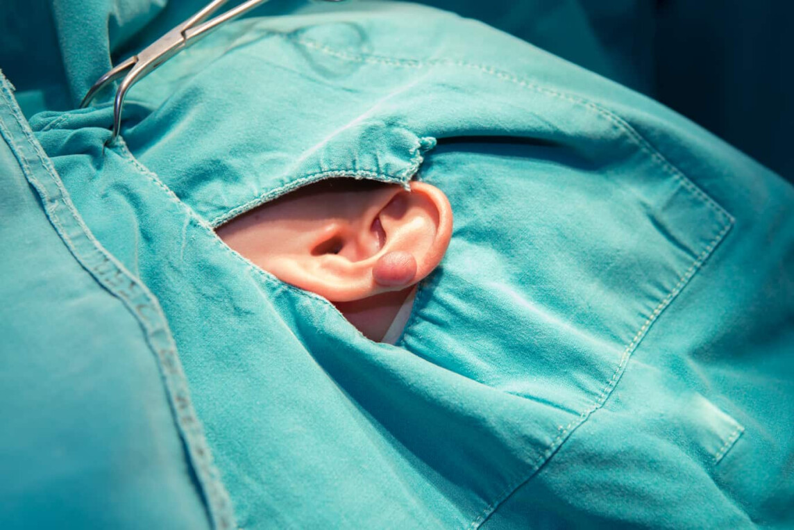 Ear Plastic Surgery in Turkey | Otoplasty in Turkey