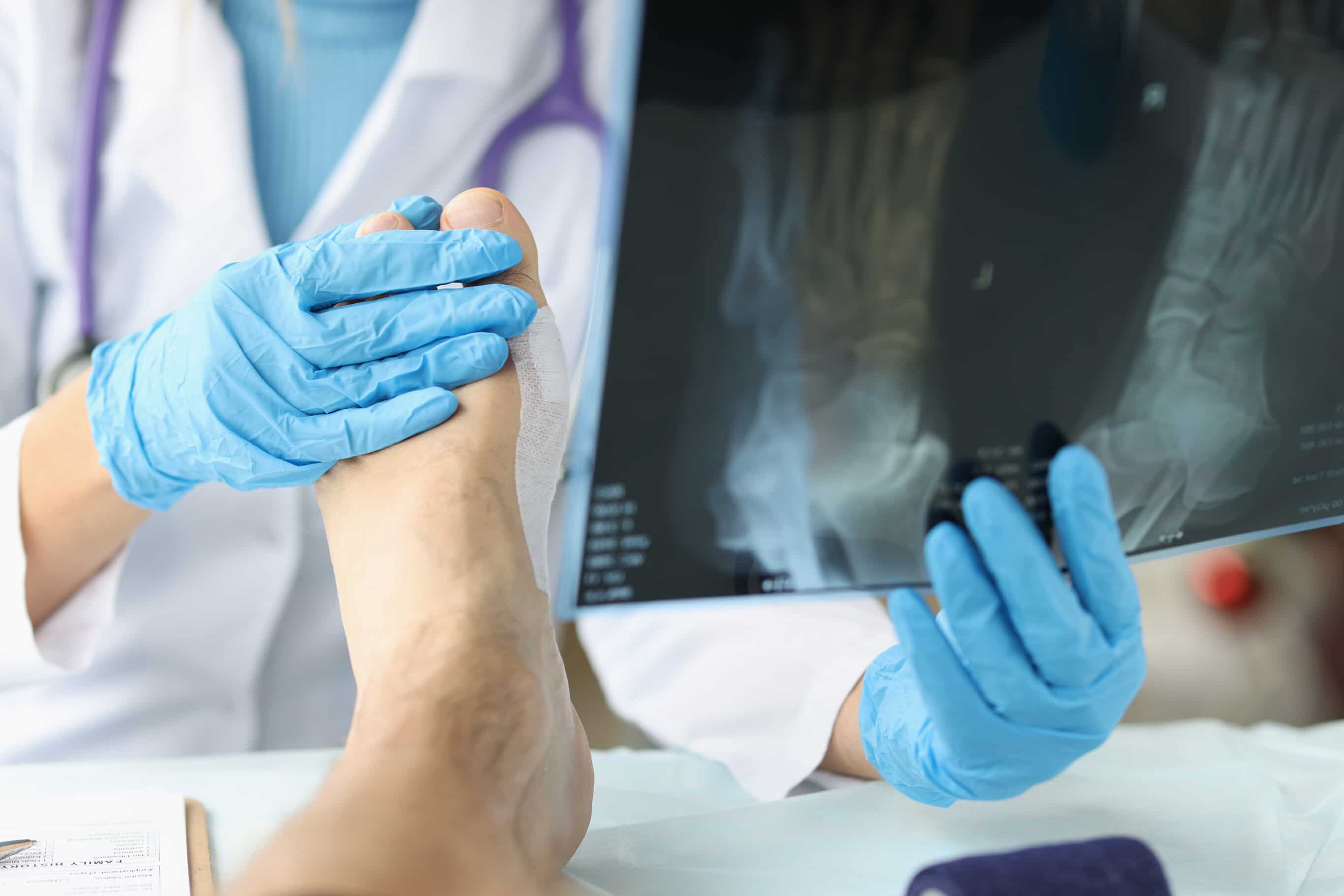 Foot and Ankle Surgery in Turkey | Prices 2026