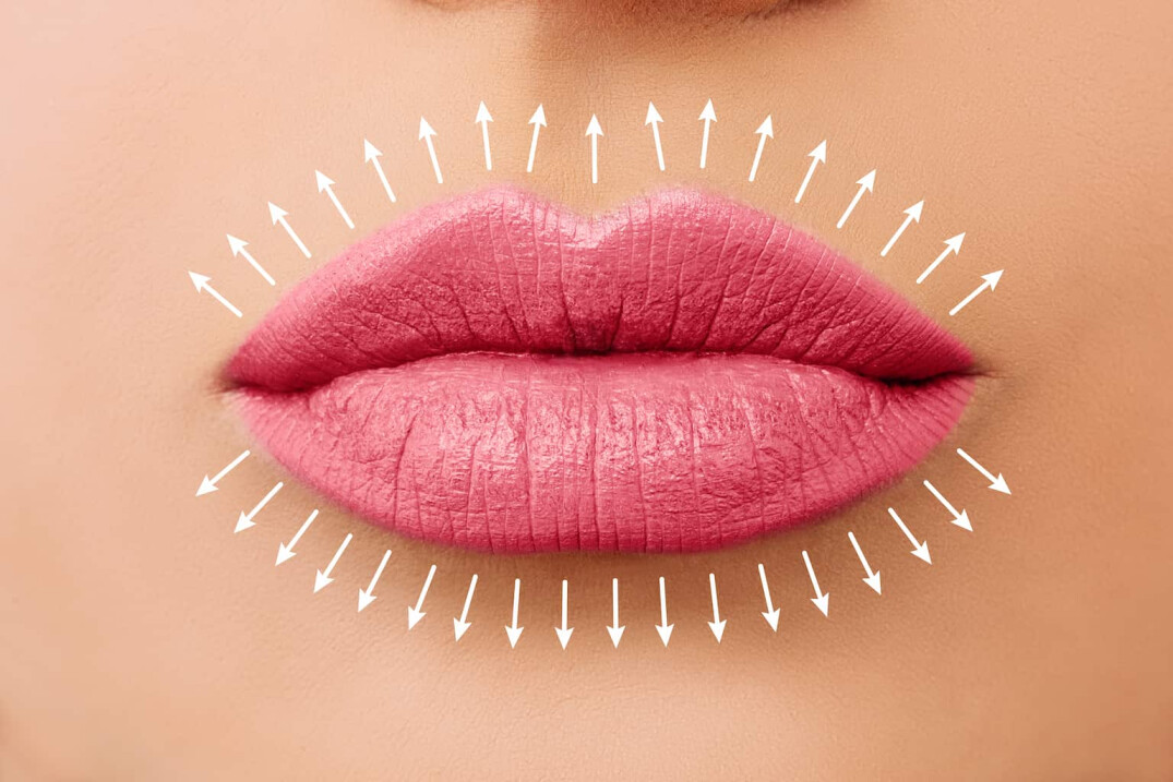 Lip Augmentation In Turkey | Check 2026 Cost and Prices