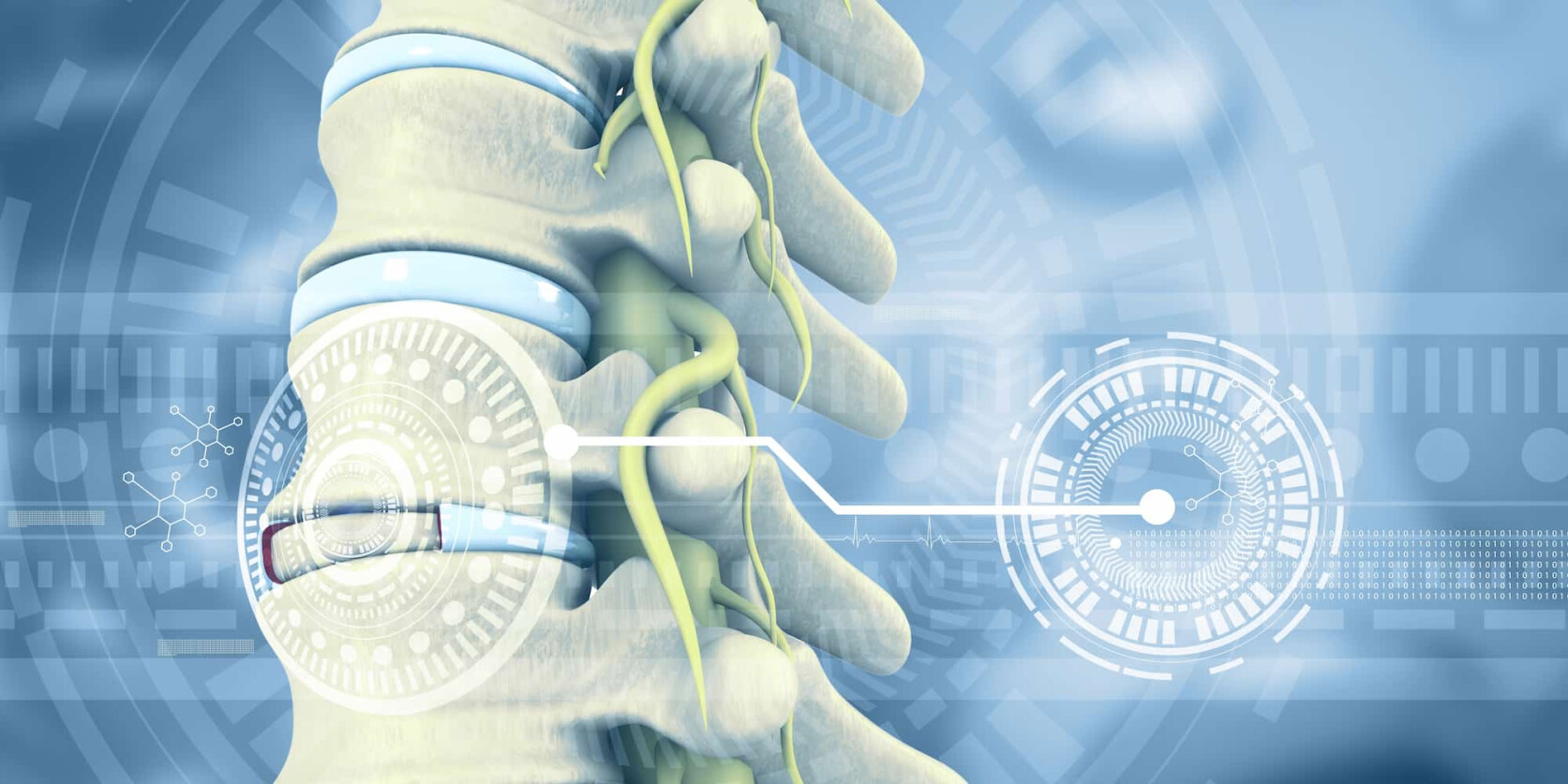 Micro Lumbar Discectomy in Turkey | Check 2026 Cost & Prices