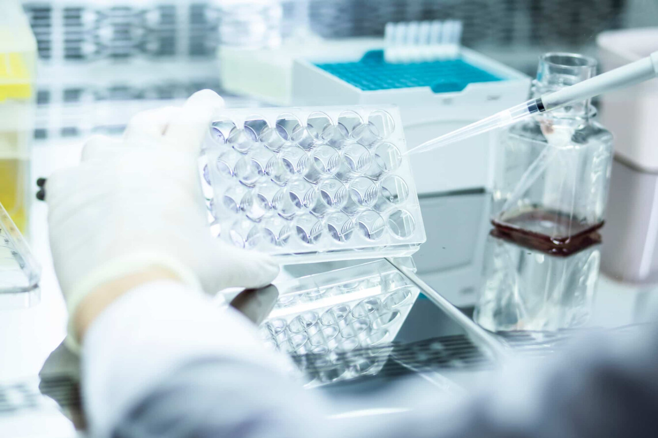 Stem Cell Therapy for Parkinson’s Disease in Turkey | Costs