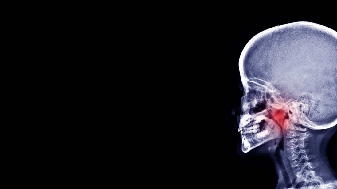 Adenoidectomy in Turkey | Adenoid Removal Surgery in Turkey