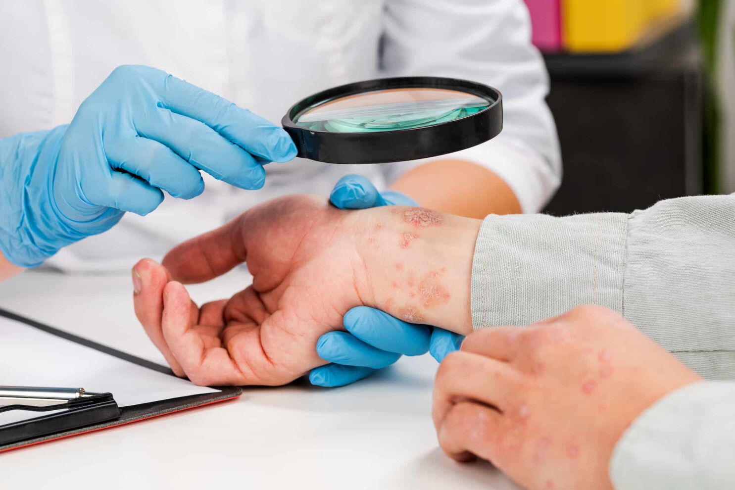 Dermatology Treatment in Turkey | Skin Treatment in Turkey
