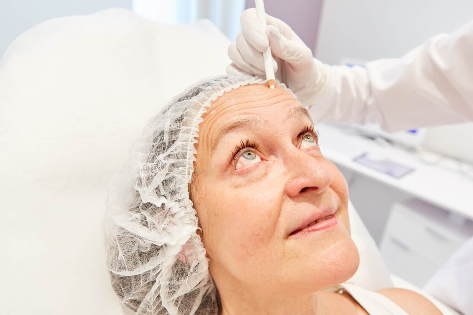 Forehead Lift Surgery in Turkey | Affordable Procedure Cost