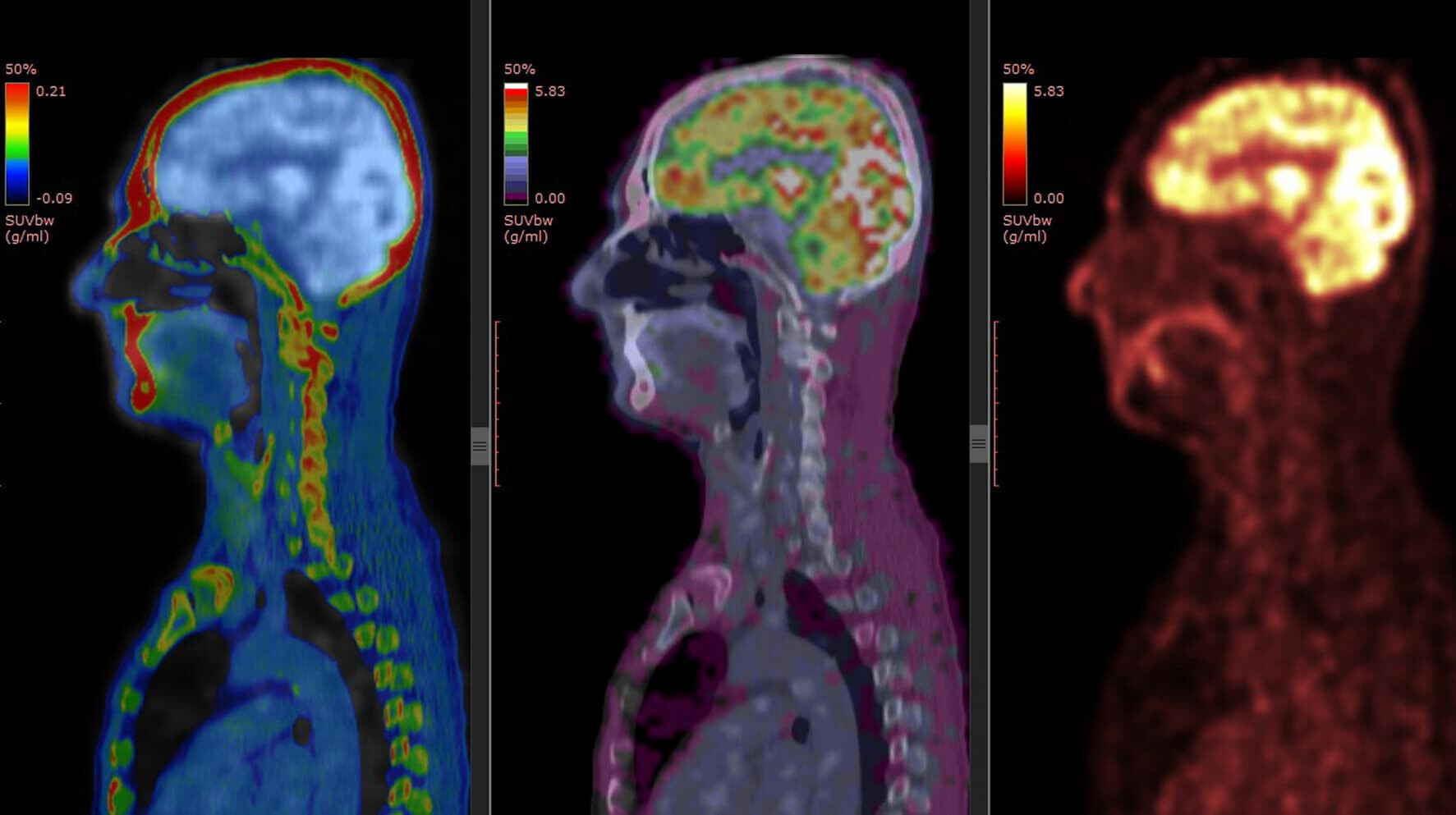 PET Scan in Turkey | Check PET Scan 2026 Costs & Prices