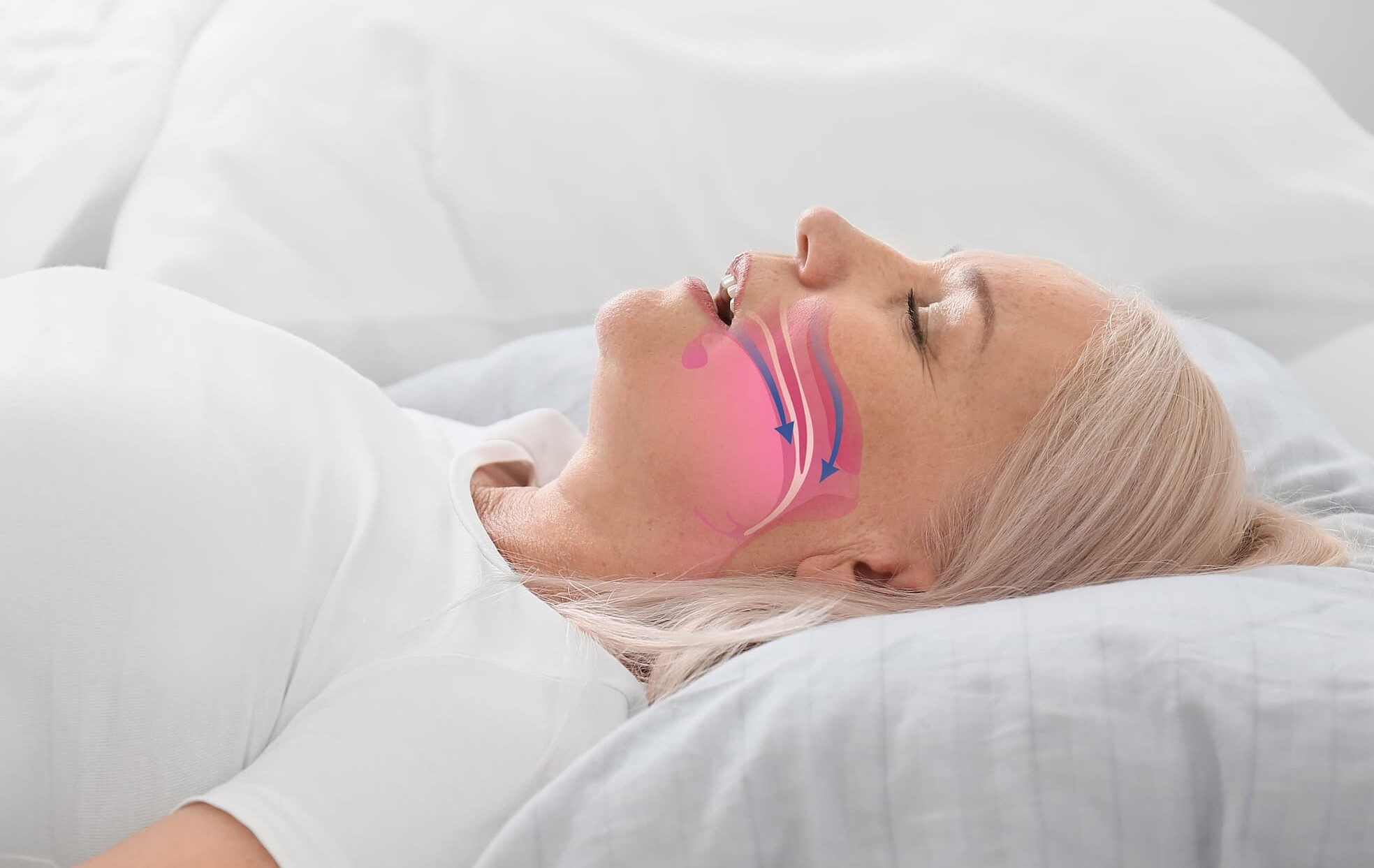 Sleep Disorders Treatment in Turkey | 2026 Costs and Prices