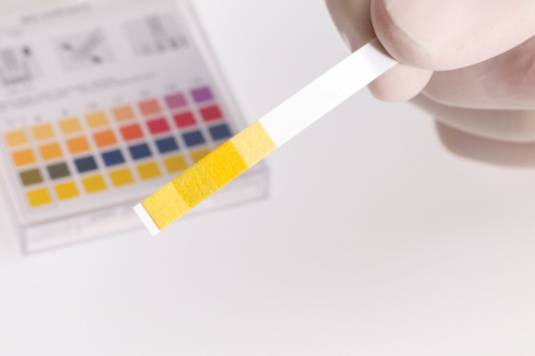 Urine Color Chart | Urology | Healthy Türkiye