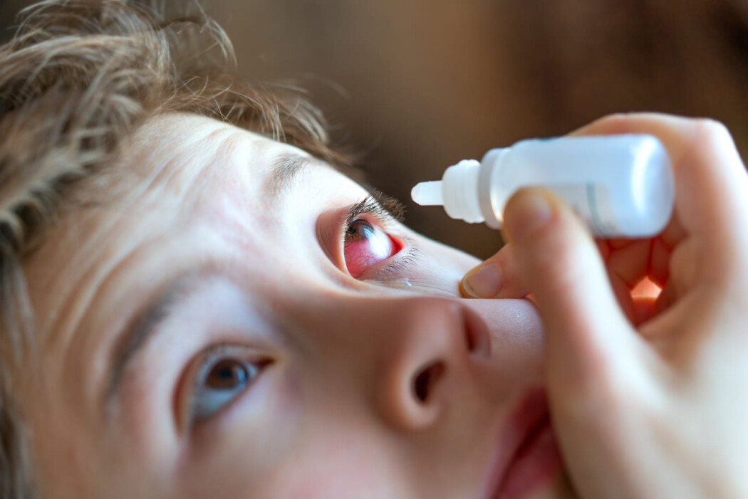 Uveitis Treatment in Turkey | Free Online Consultation